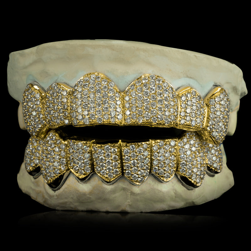 Custom VS Diamond Grillz- Top – Gold n Threadz